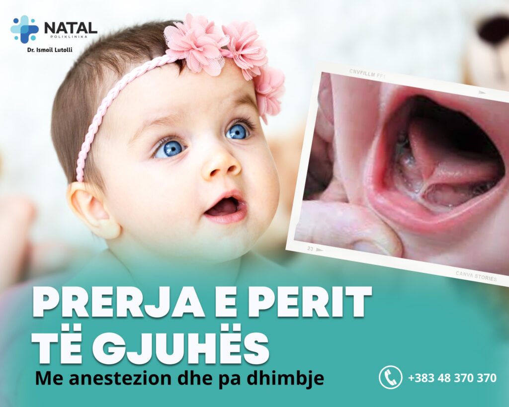 Rakiti - NATALMedia