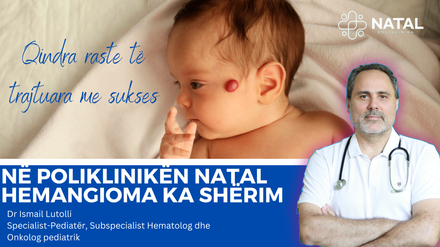 NË POLIKLINIKËN NATAL HEMANGIOMA KA SHËRIM